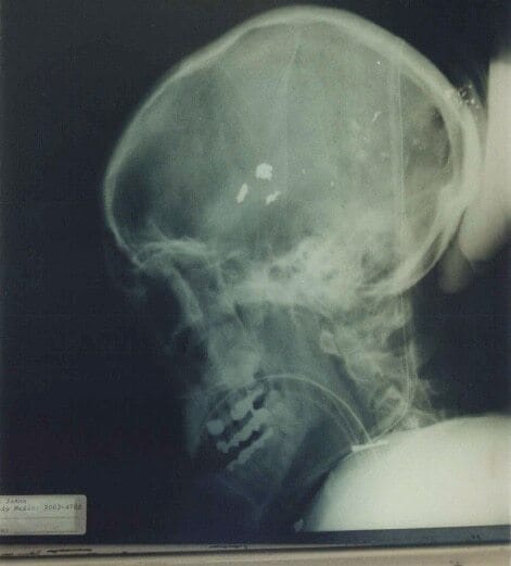 Habla el asesino: Earl Forrest, venganza - AMC CHANNELS